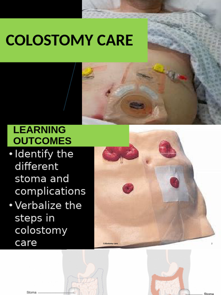 Colostomy_care.pptx | PDF | Clinical Medicine | Medical Specialties