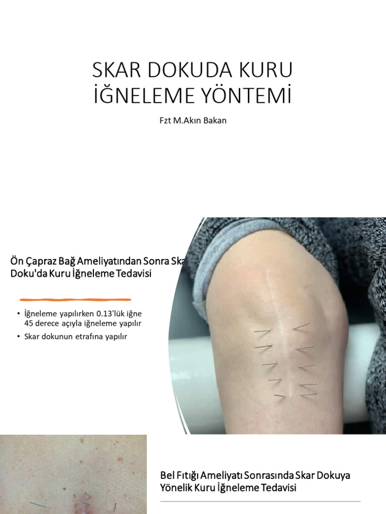 Skar Doku Yaralanmaları | PDF
