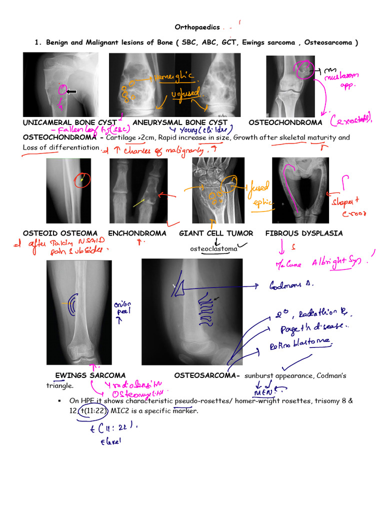 Imp Topics Ortho Explained | PDF | Rheumatoid Arthritis | Musculoskeletal Disorders