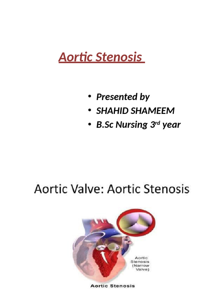 Aortic Stenosis Pdf
