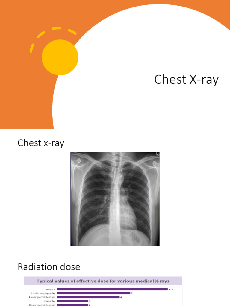 Chest X-ray Interpretation Guide | PDF
