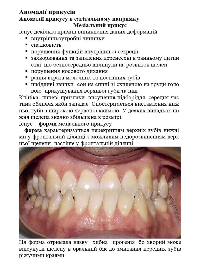 Anomalii Prykusiv | PDF