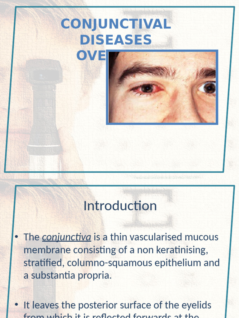 Conjunctival Diseases | PDF | Diseases And Disorders | Medical Specialties