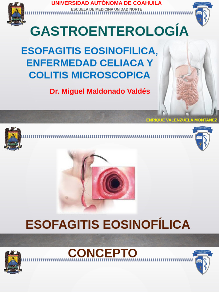 Esofagitis Eosinofilica, Enfermedad Celiaca y Colitis Microscopica ...
