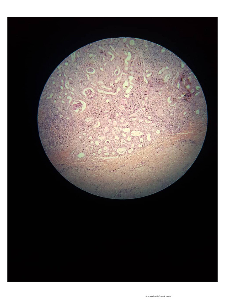 3rd Year Histo-patho Slides and Gross | PDF