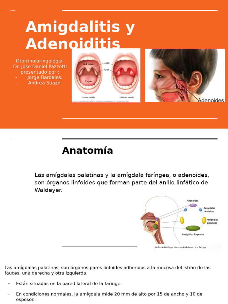 Amigdalitis y Adenoiditis | PDF | Desorden hiperactivo y deficit de atencion | Especialidades ...