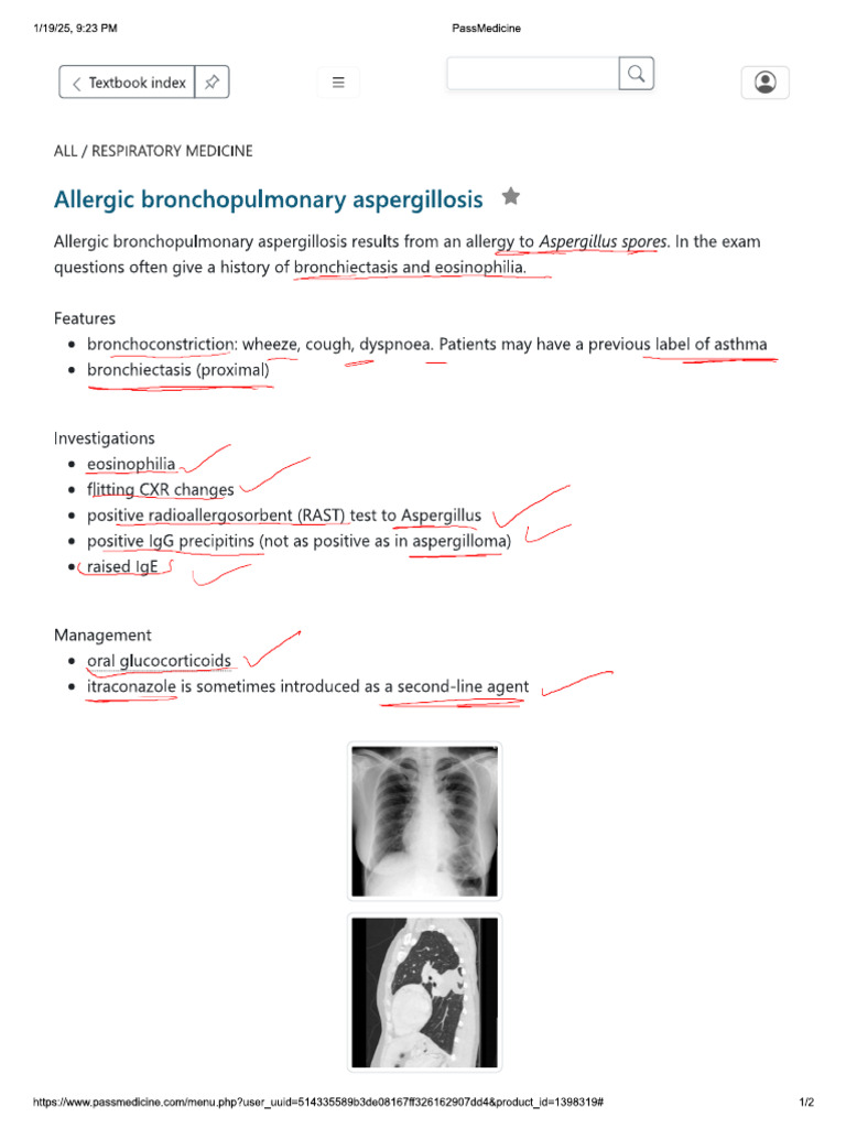 Allergic Bronchopulmonary Aspergillosis | PDF
