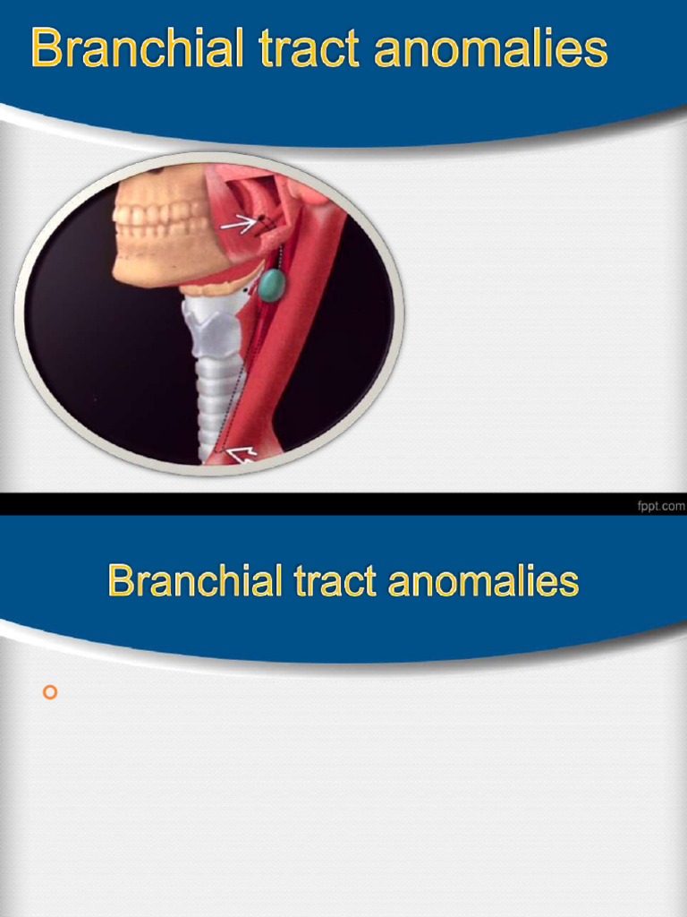 Branchial cyst-fistula (1) | PDF | Epithelium | Neck