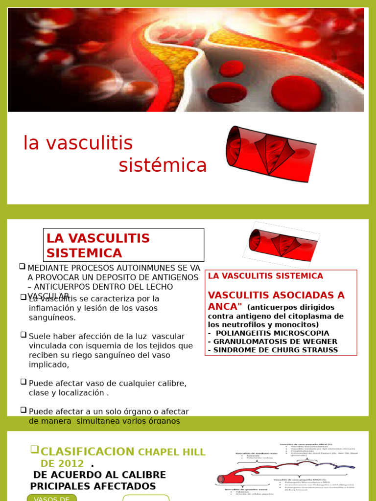 Vasculitis | PDF | Especialidades Medicas | Enfermedades y trastornos