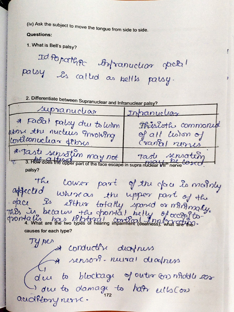 Cranial Nerve 7to 12 | PDF | Human Anatomy | Symptoms And Signs