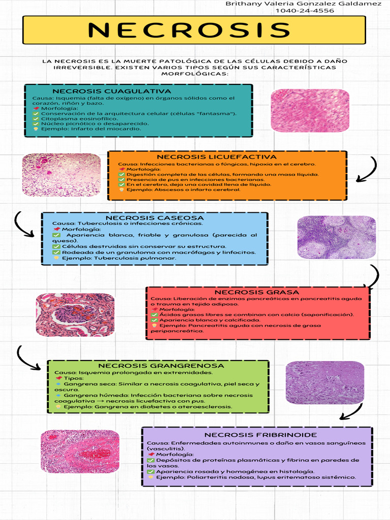 Infografía de Necrosis | PDF | Isquemia | Infarto de miocardio