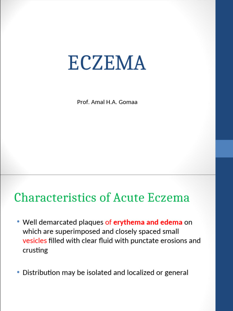 Understanding Eczema Types and Treatments | PDF | Dermatitis | Allergy
