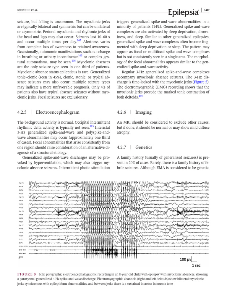 International League Against Epilepsy classification and definition of epilepsy syndromes 2022 ...