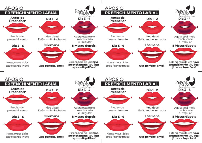 A98fbe07 29d7 4a77 Bcbe Cf96d10bb332Fases Preenchimento Labial | PDF