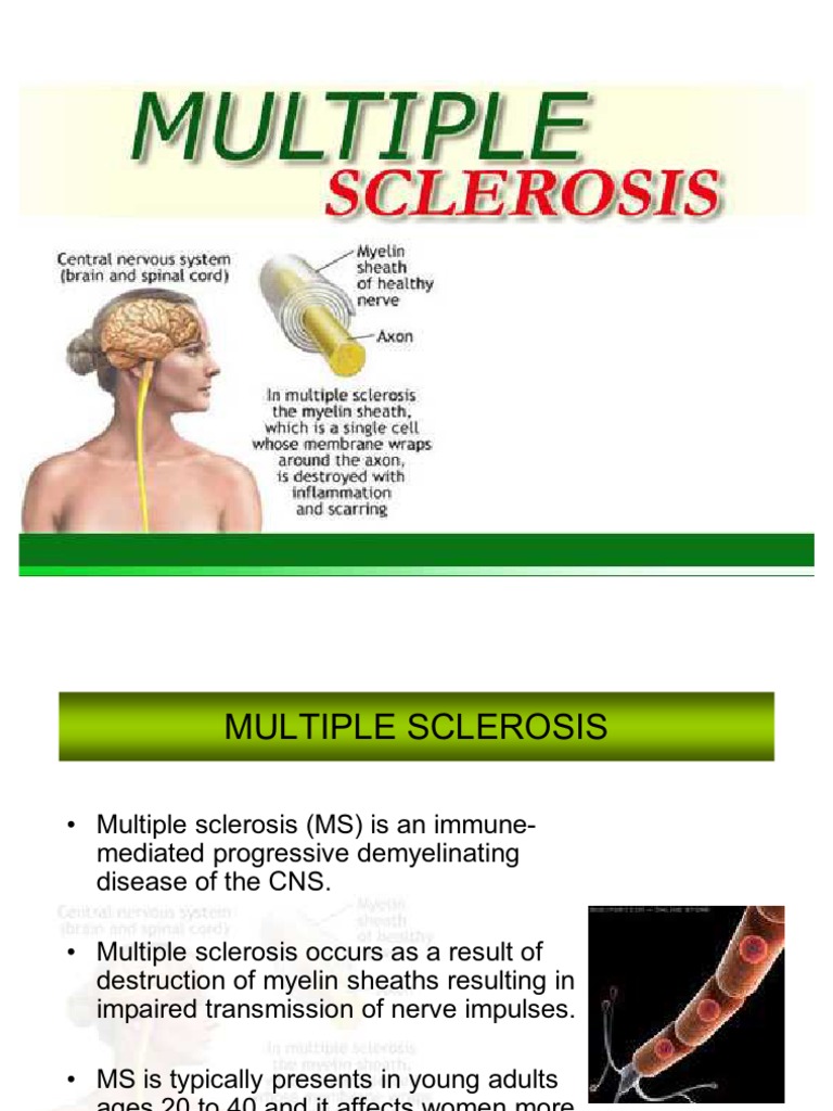 Multiple Sclerosis New | PDF | Multiple Sclerosis | Myelin