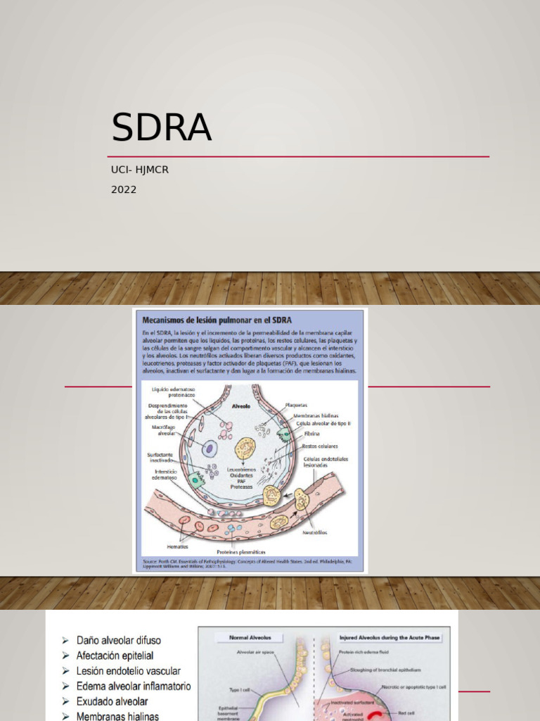 Sdra | PDF