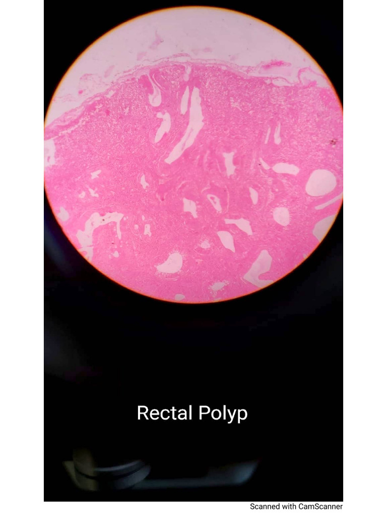 Pathology University Slides 3 | PDF