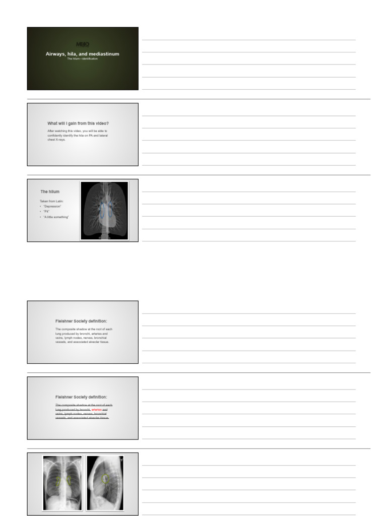 Identifying Hila on Chest X-Rays | PDF | Lung | Thorax (Human Anatomy)