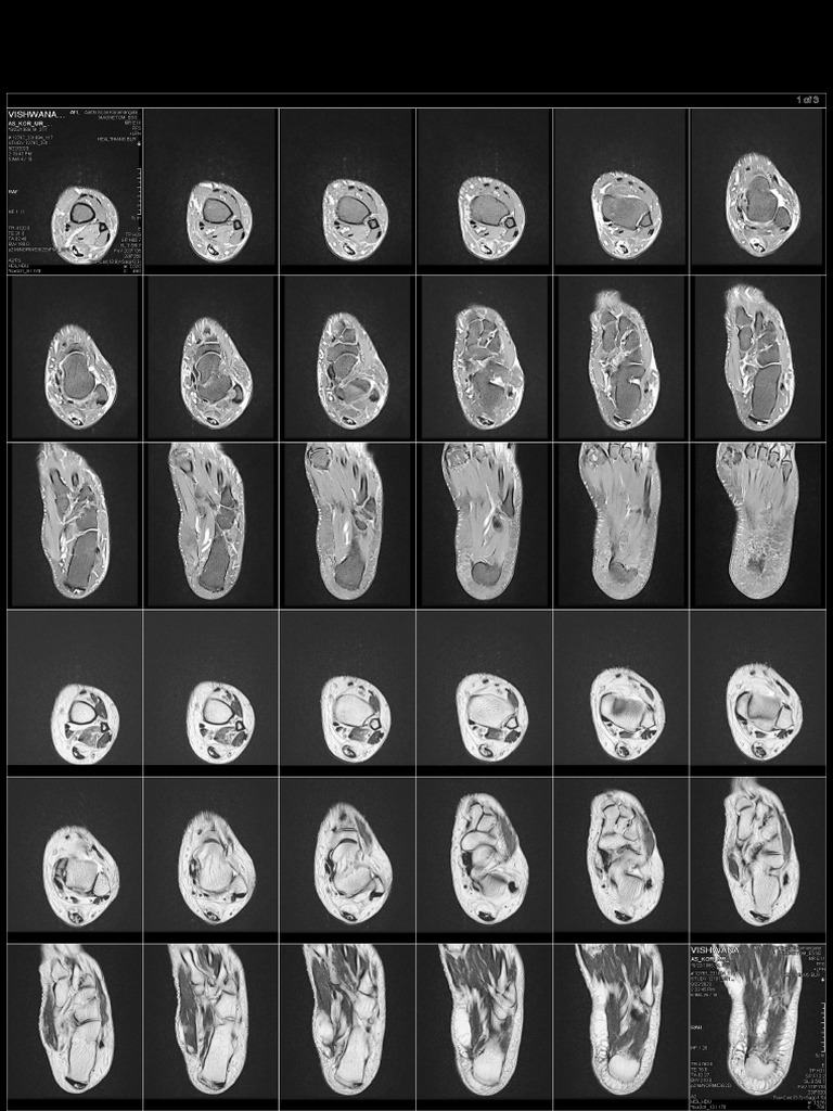 MRI Scan Information PDF | PDF
