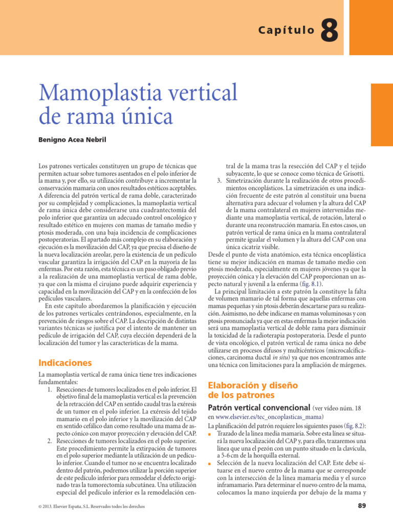 Mamoplastia Vertical de Rama Única: Técnica y Aplicaciones | PDF ...