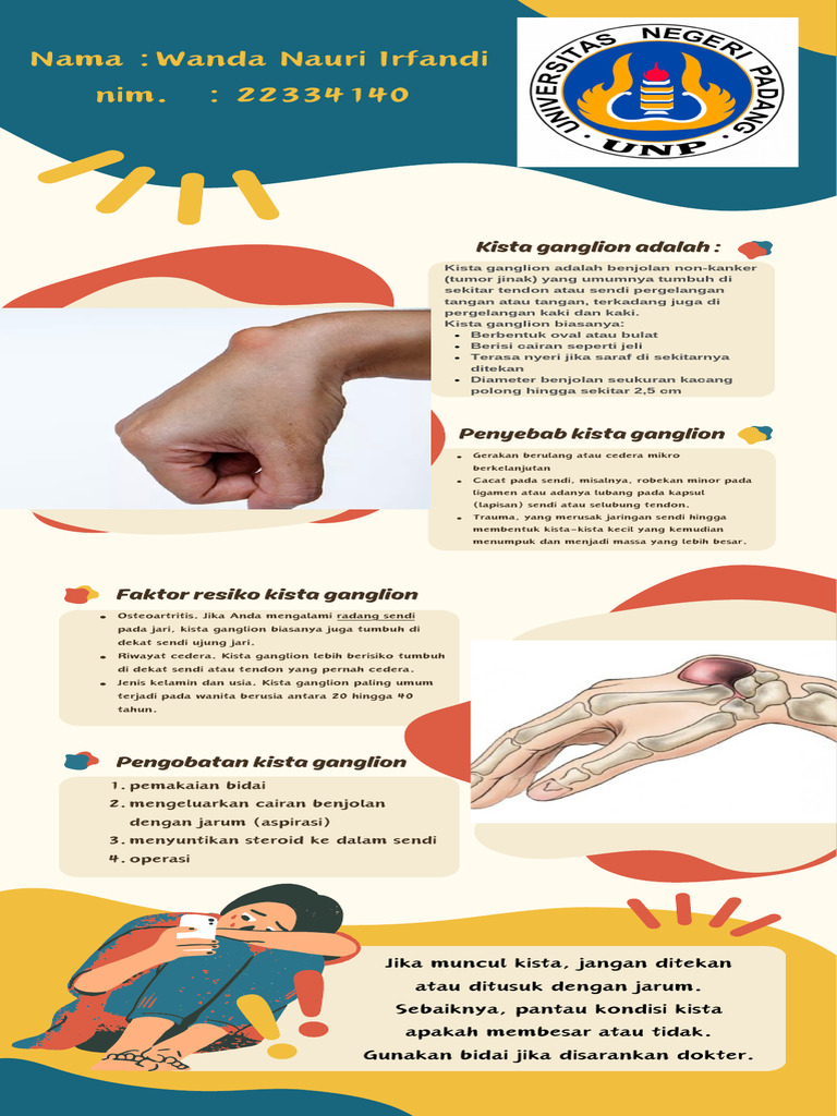 Poster Kista Ganglion | PDF
