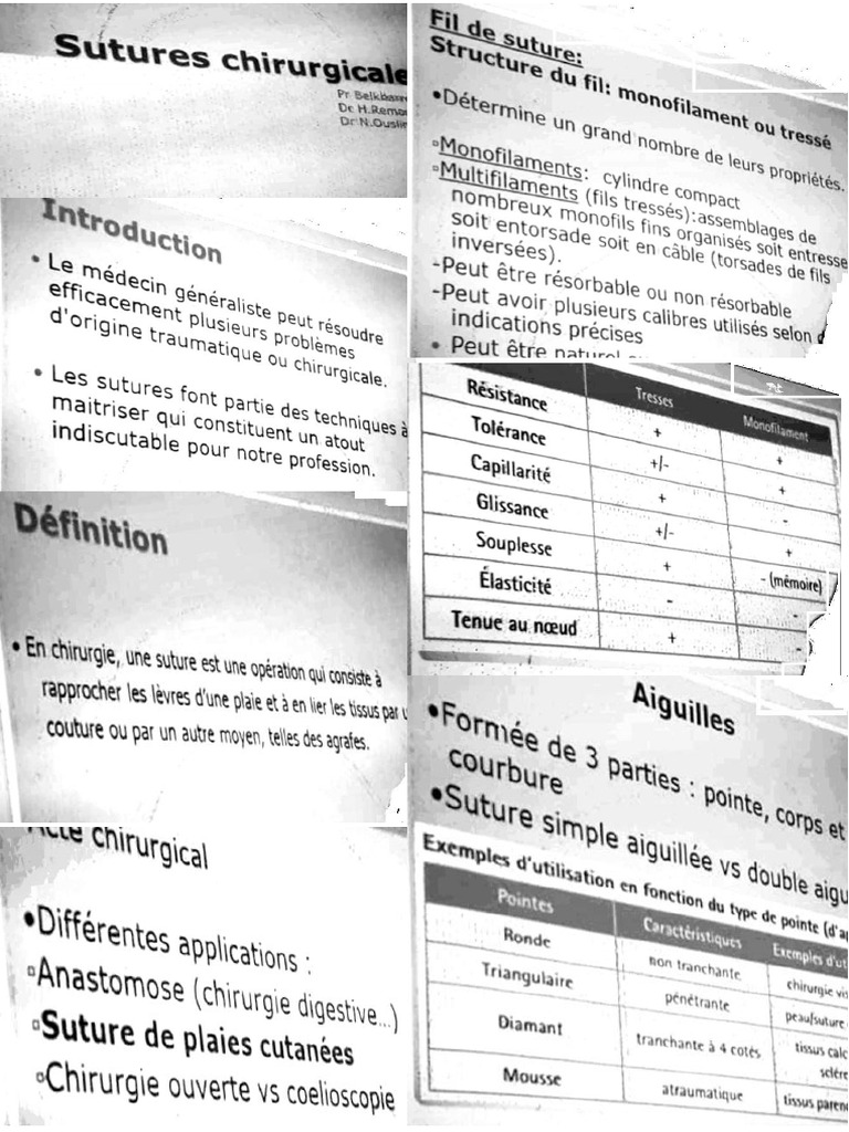 TD3 - Sutures-Chirurgicales | PDF