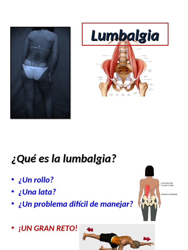 Lumbalgia | PDF | Dolor lumbar | Rodilla