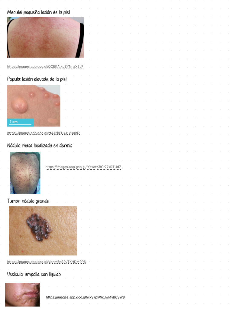 c4 Lesiones de La Piel | PDF