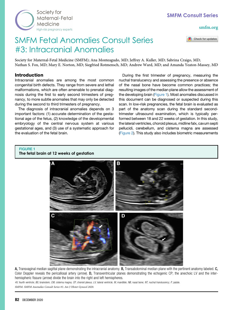Fetal Brain Anomalies Guide | PDF | Pregnancy | Diseases And Disorders