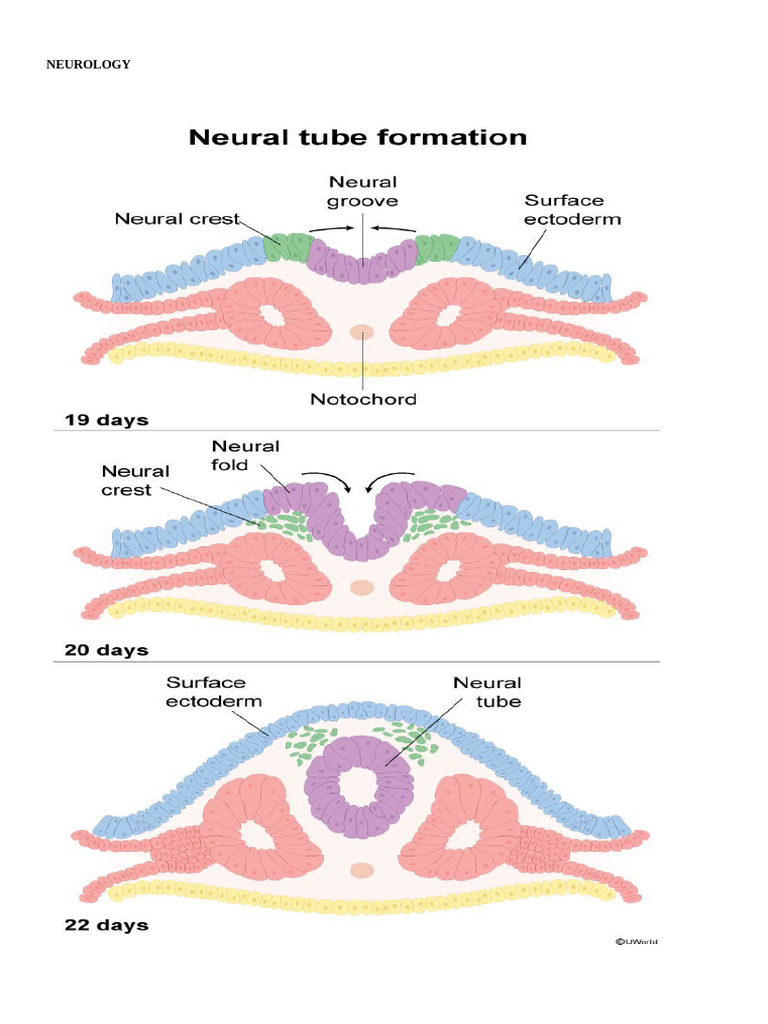 Anencephaly and Neural Tube Defects | PDF | Nervous System | Medical ...