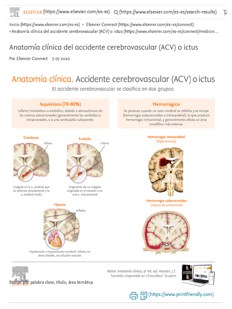 Anatomía Clínica Del Accidente Cerebrovascular (ACV) o Ictus | PDF | Carrera | Anatomía
