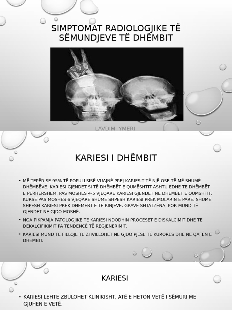Simptomat Radiologjike TÃ_ SÃ_mundjeve TÃ_ DhÃ_mbit | PDF