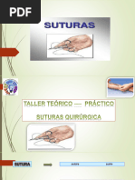 Suturas Ligaduras y Nudos | PDF | Sutura Quirúrgica | Cicatrización de la herida