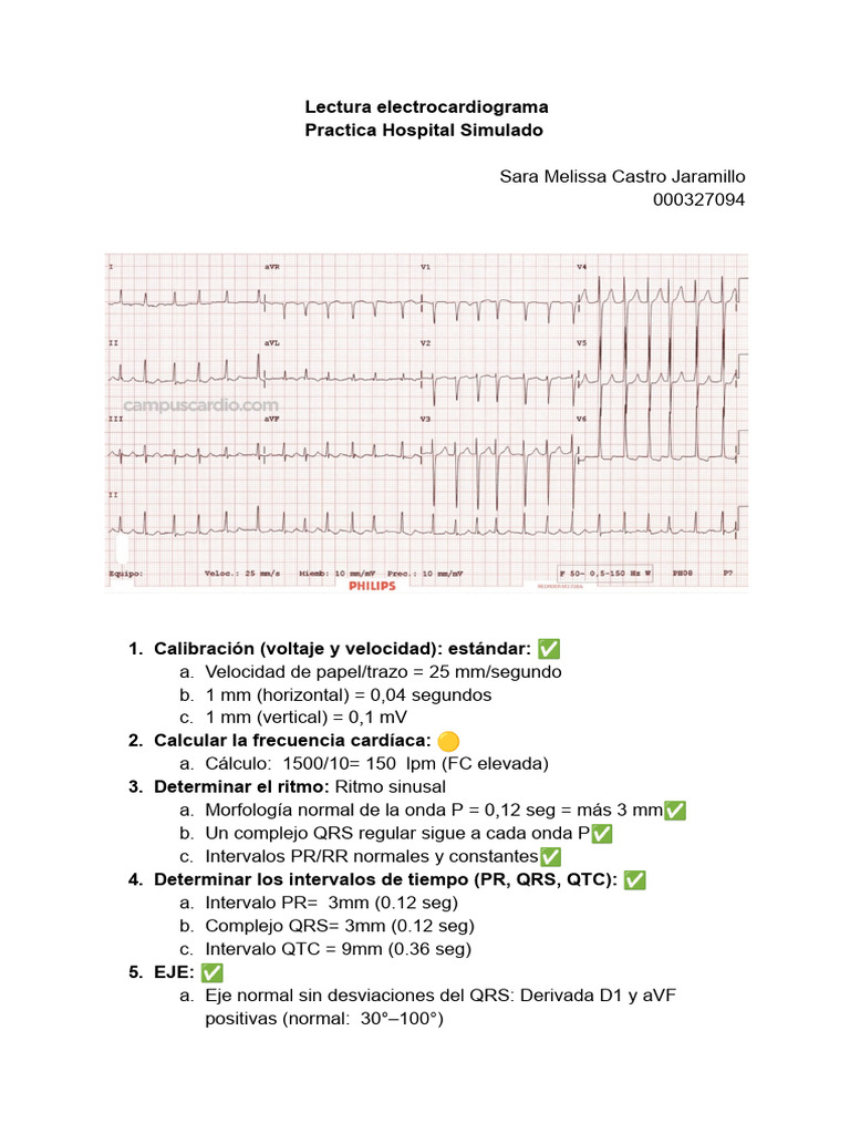 Lectura Electrocardiograma | PDF | Cardiología | Electrofisiología cardíaca