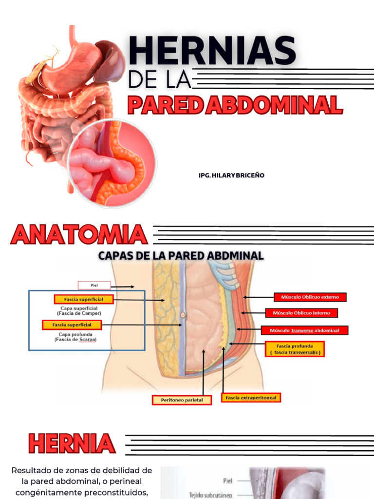 Hernias | PDF | Abdomen