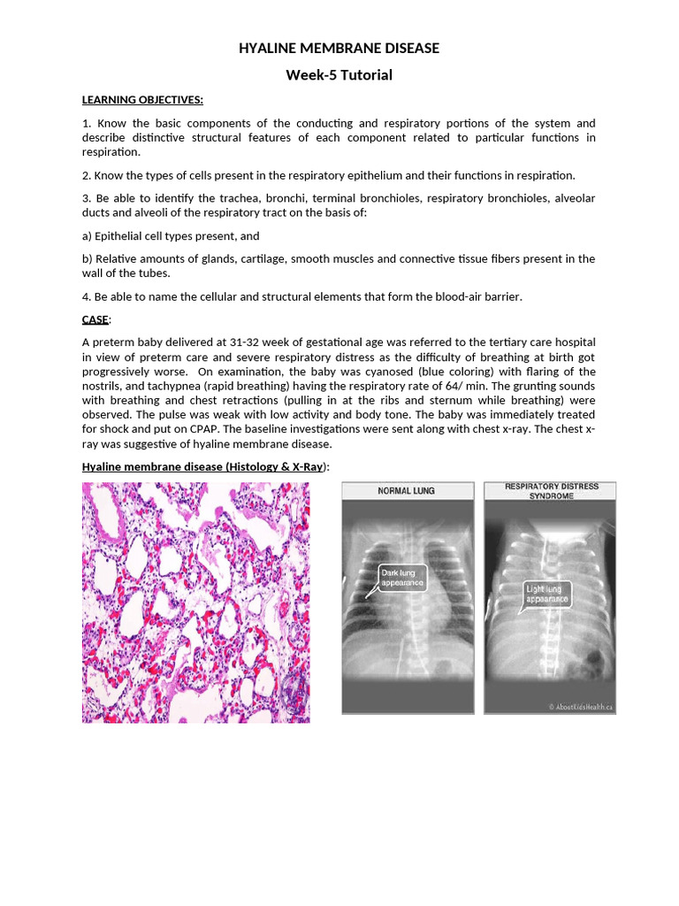 Hyaline Membrane Disease | PDF