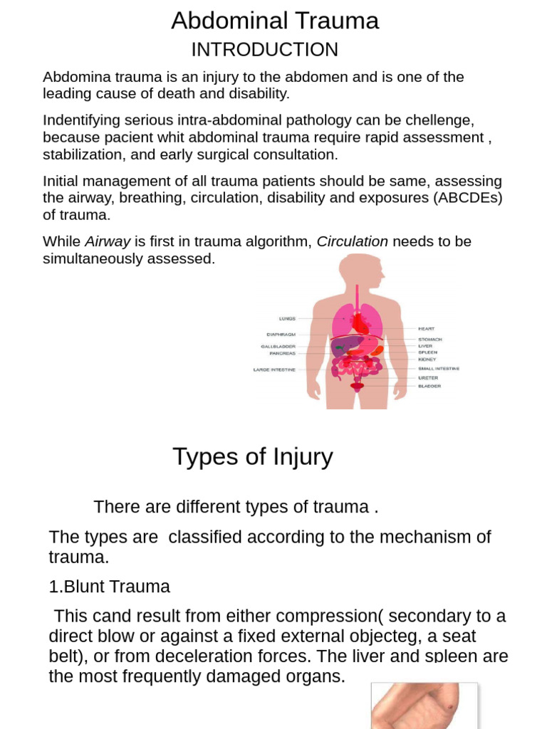 New OpenDocument Presentation 2 | PDF | Major Trauma | Traumatology