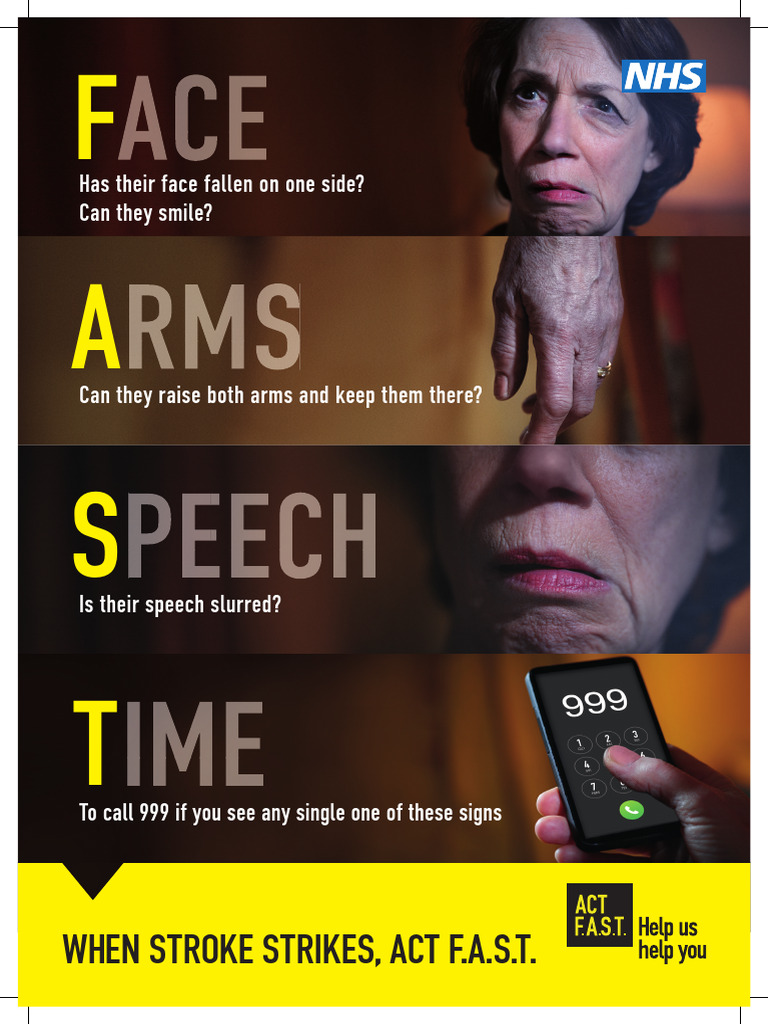 Nhs-Act-Fast-Stroke Female A4 Leaflet HR | PDF | Stroke | Medical ...