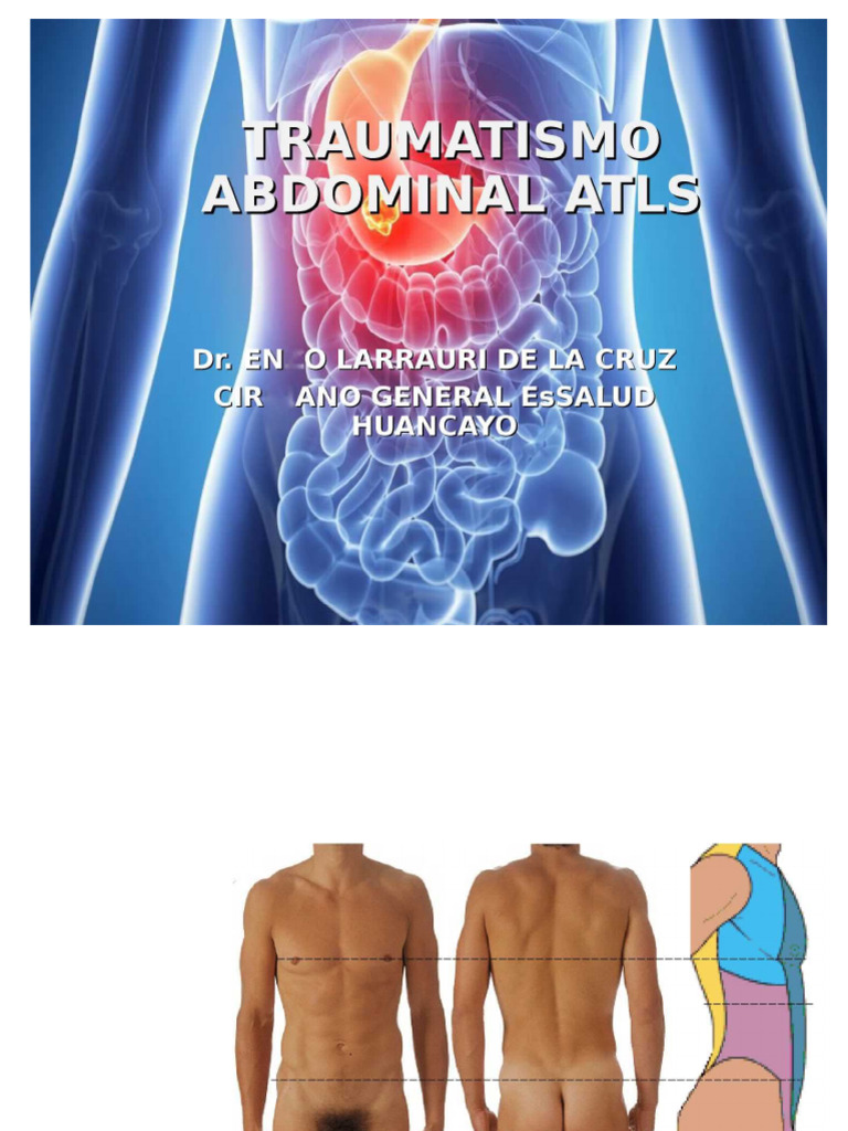 Trauma Abdominal ATLS Enzo | PDF | Peritoneum | Abdomen