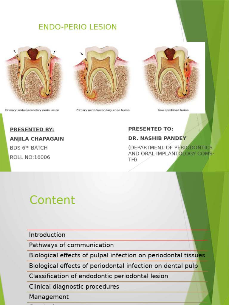 Endo perio lesion Perio (2) | PDF | Periodontology | Dental Anatomy