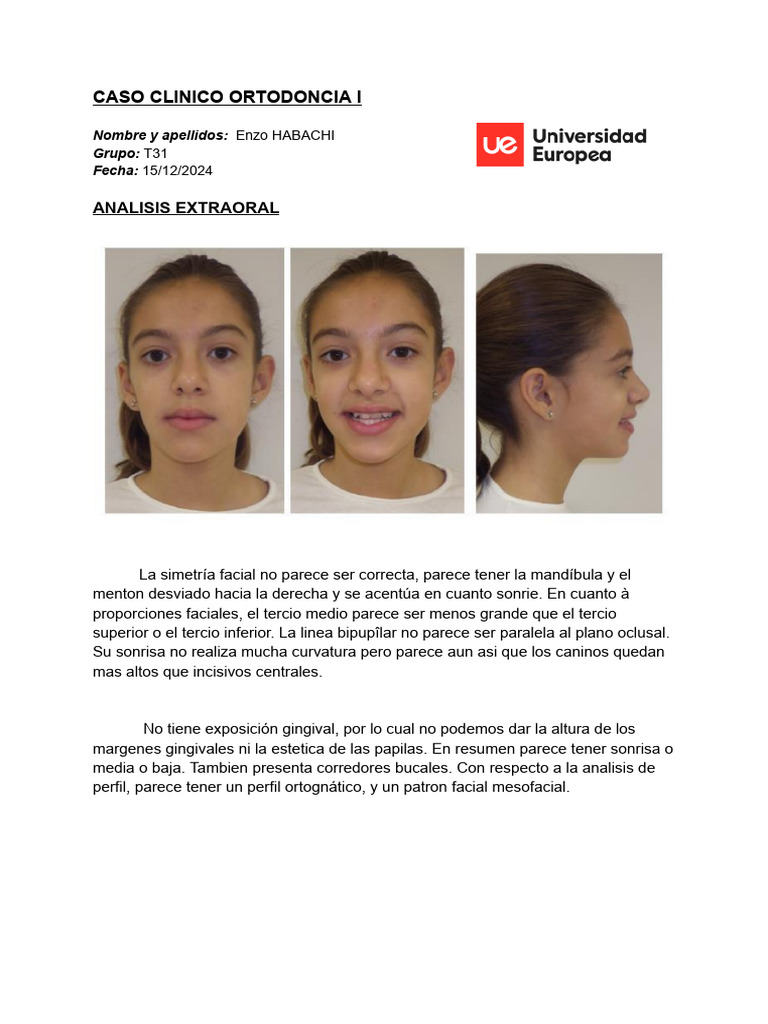 Caso Clinico Ortodoncia I Enzo Habachi t31 | PDF