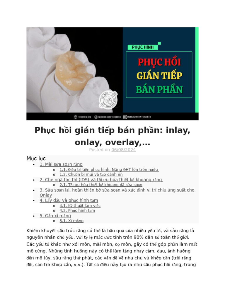Phục hồi gián tiếp bán phần inlay-onlay | PDF