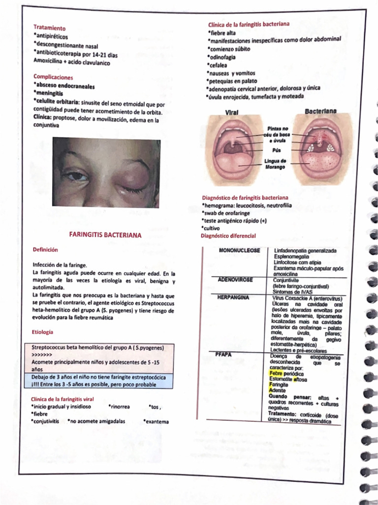 Faringitis Bacteriana | PDF