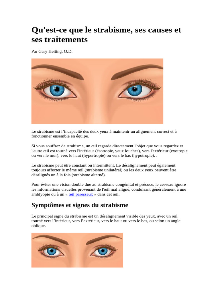 Strabisme : Causes, Symptômes et Traitements | PDF | Vision | Œil humain