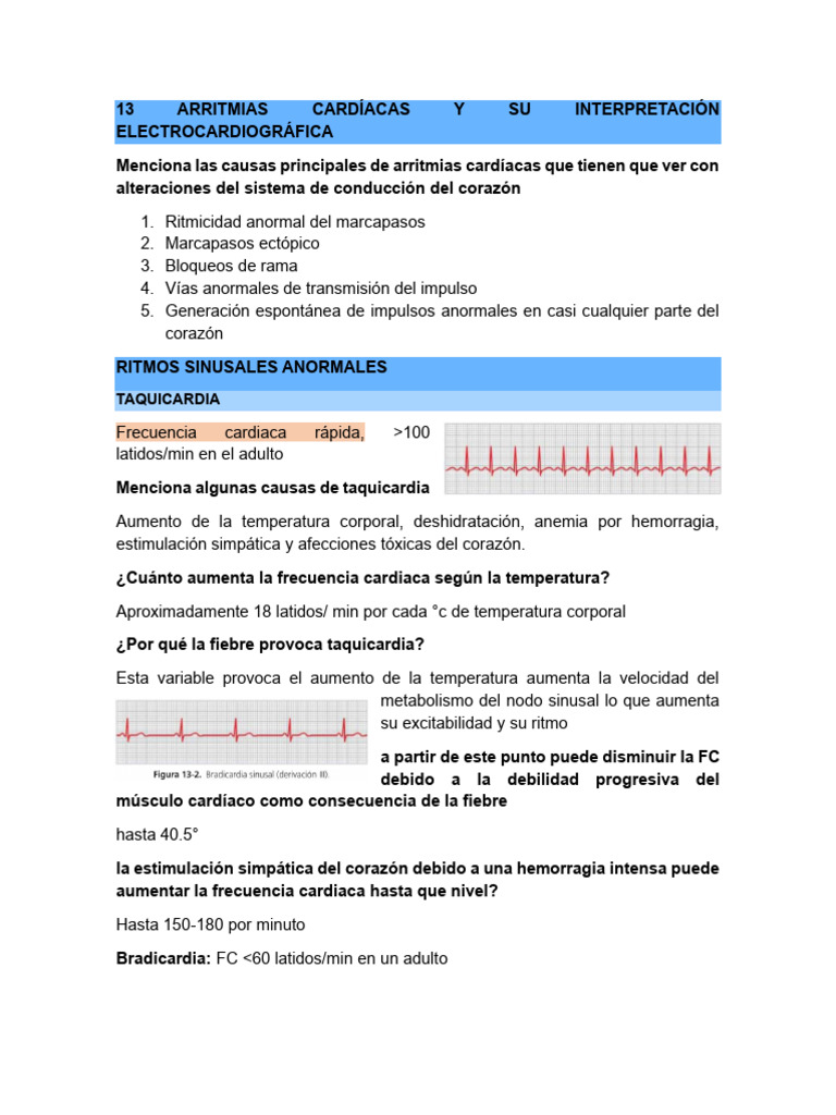 13 Arritmias Cardíacas y Su Interpretación Electrocardiográfica | PDF | Enfermedades y ...