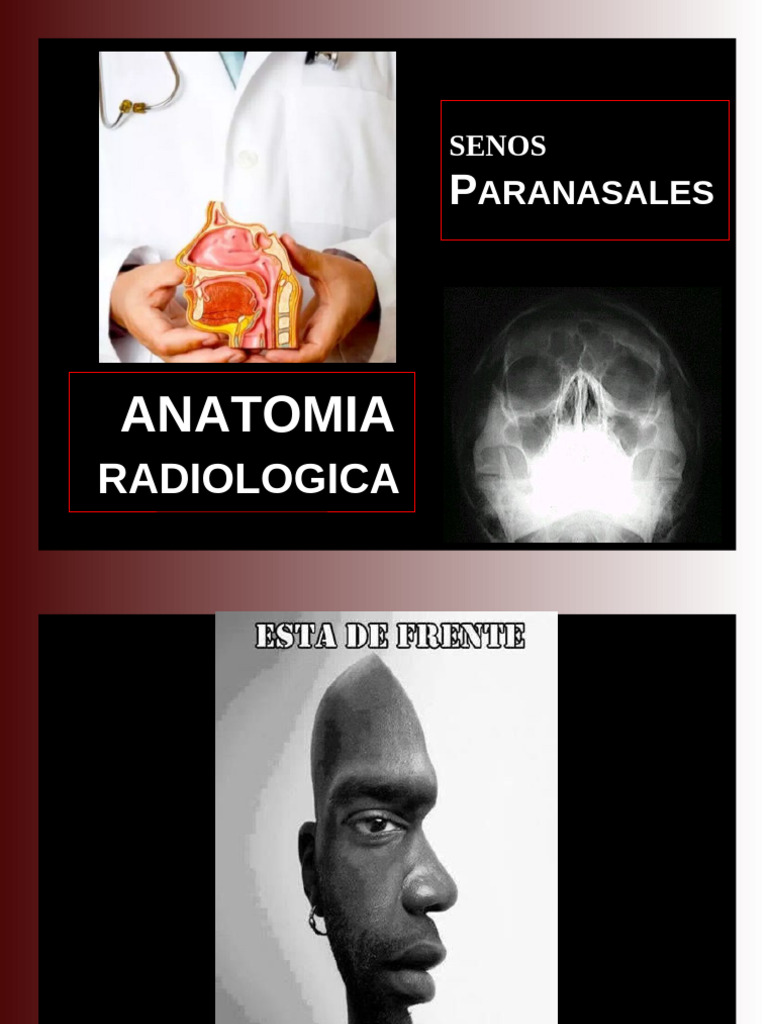 Anatomía y Exploración de Senos Paranasales | PDF | Anatomía humana ...