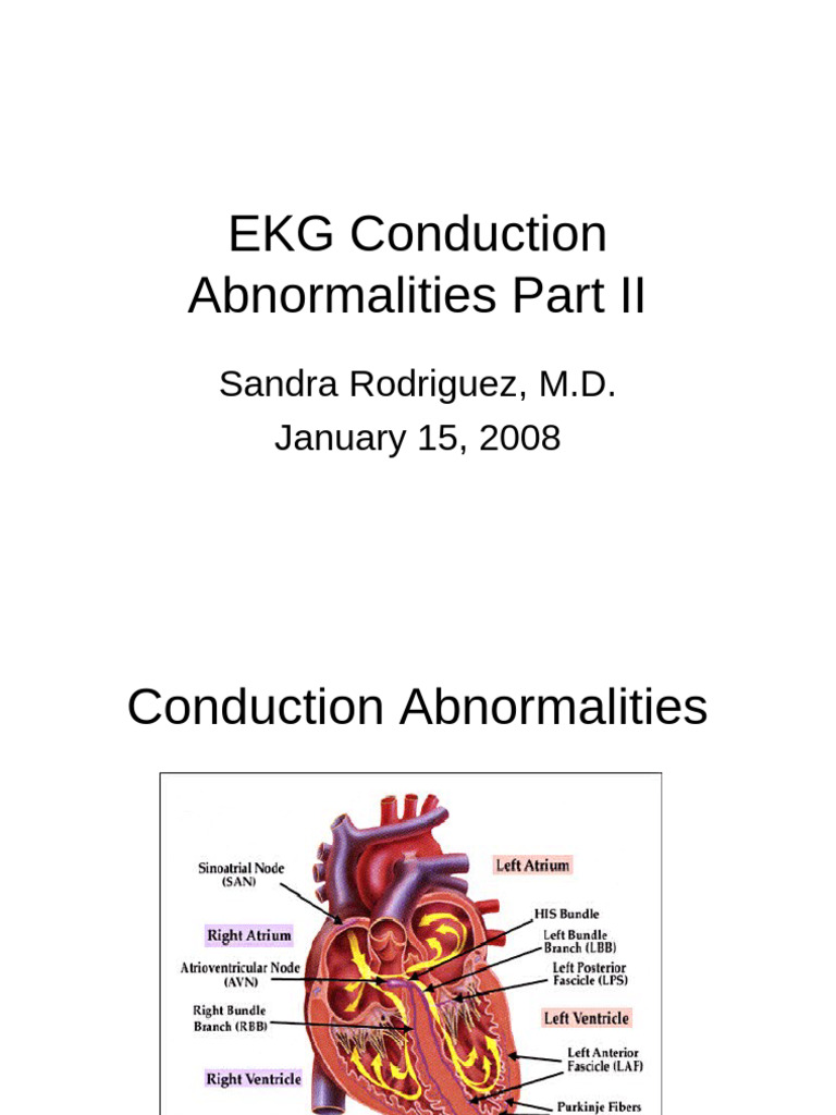 Ekg Conduction Abnormalities PartII | PDF | Heart | Cardiology