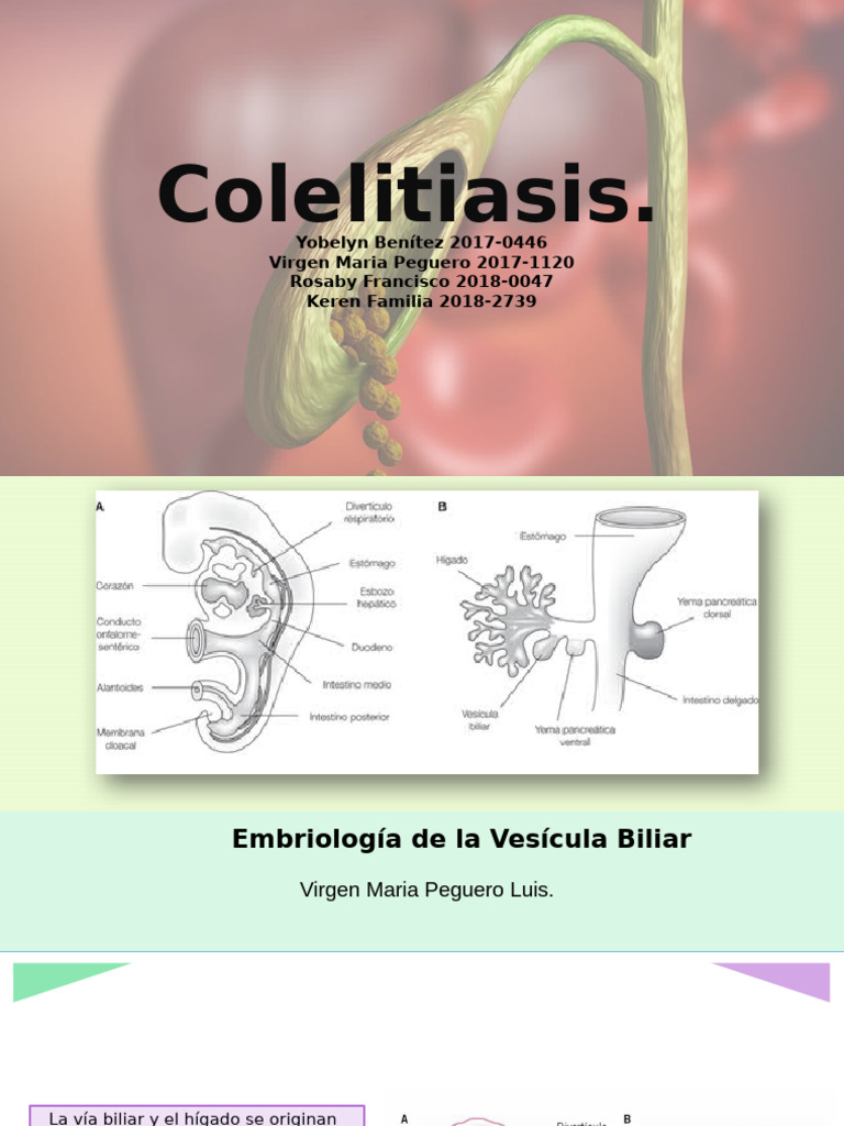 Guía Completa sobre Colelitiasis | PDF | Bilis | Vesícula biliar