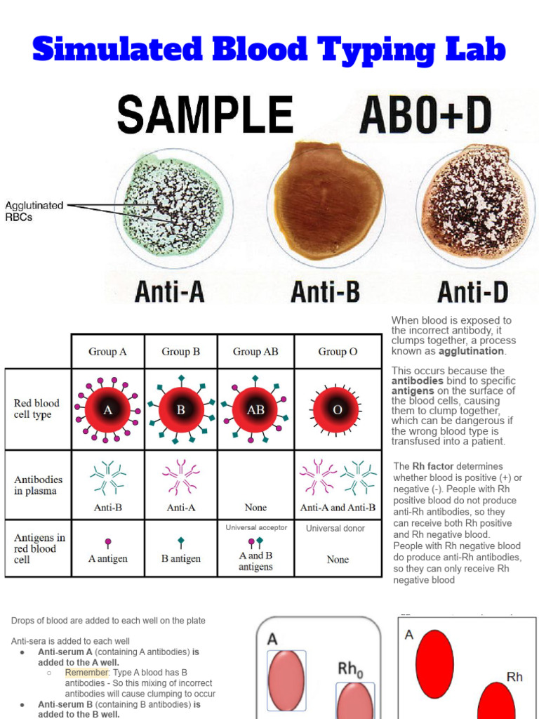 Chloe, Talina, Senaiya - Blood Typing Lab & Review Questions | PDF ...