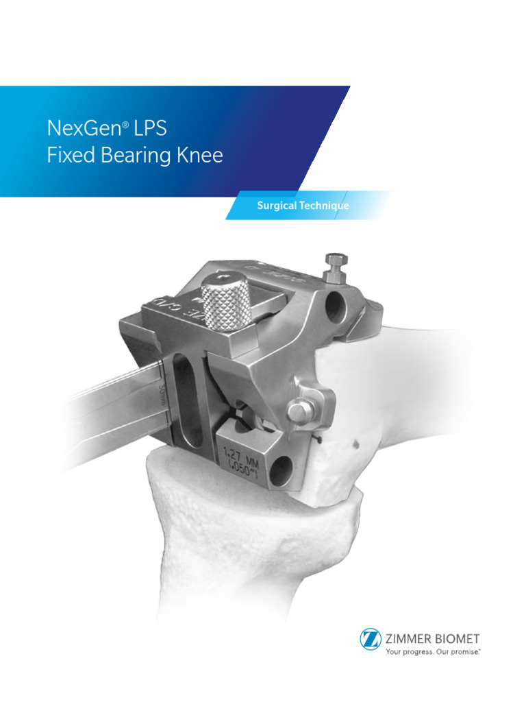 1393.1-GLBL-en NexGen LPS Fixed Bearing Knee SurgTech-DIGITAL | PDF ...
